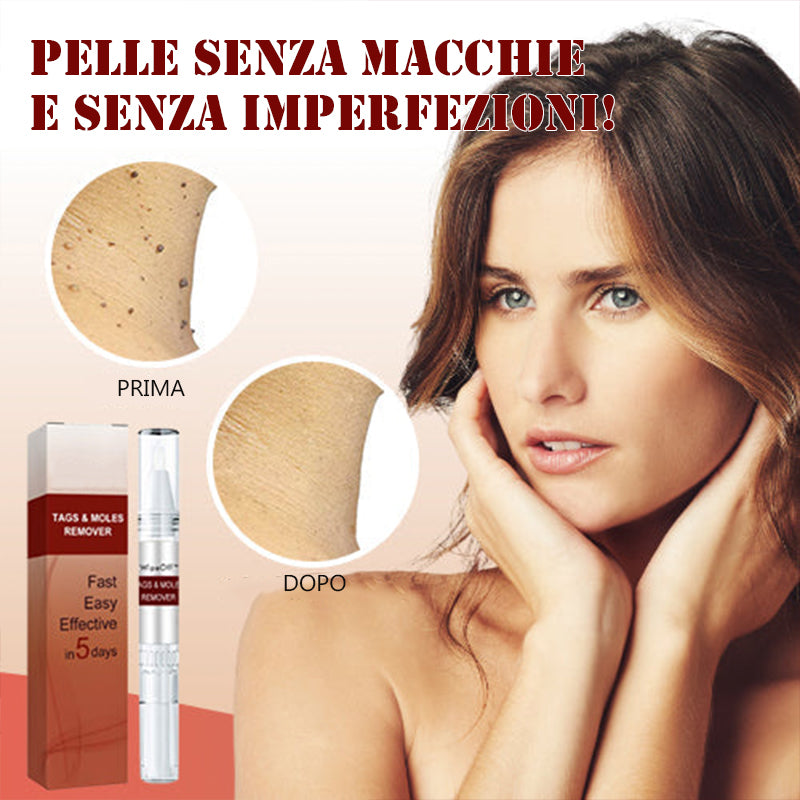 Essenza per la rimozione di macchie e nei - 1 acquisto e 1 gratis (2 p ...