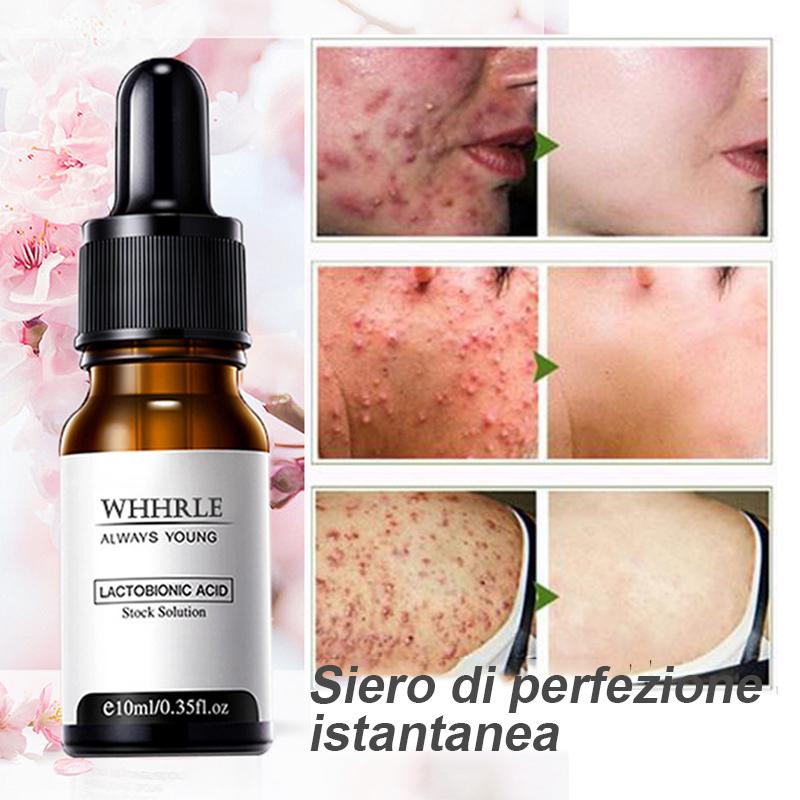 Nuova essenza antirughe (Acquista 1 e ricevi 1 gratis🎁) – Risoluce